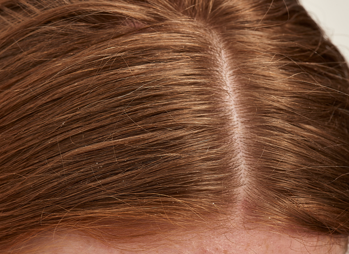 Scalp Health 101 | The INKEY List