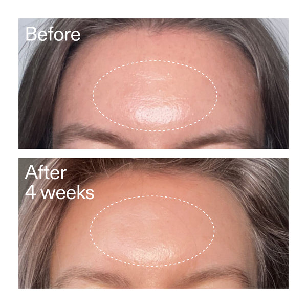 Advanced 0.2% Retinal Serum - 11x Faster Than Retinol | The INKEY List