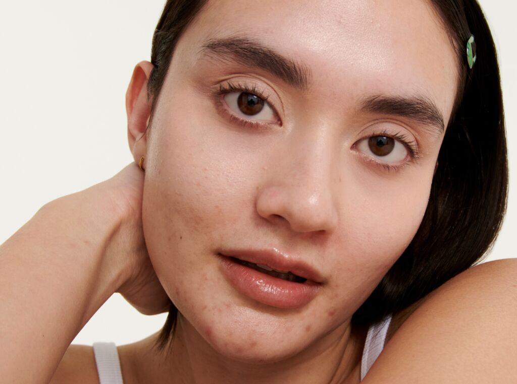 AI Skin Analysis Tool for Breakout Prone Skin | Skin Scanner