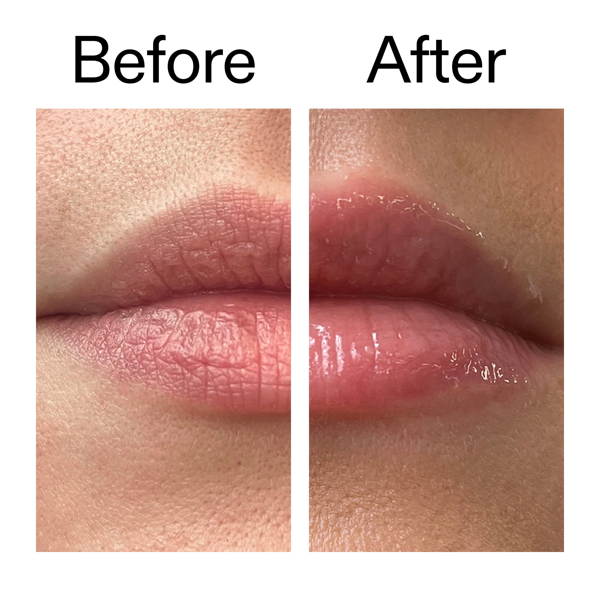 Best Tripeptide Plumping Lip Balm - +40% Volume Boost | INKEY UK